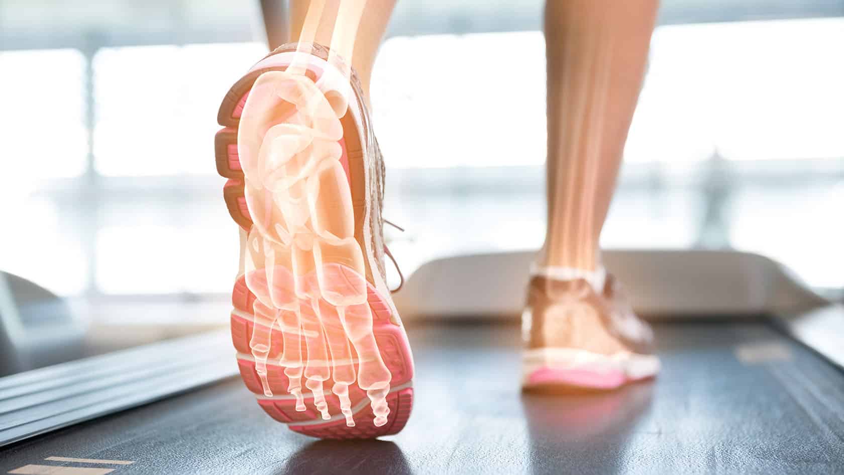Foot Levelers 3D Foot Scanner | Custom Orthotics Omaha